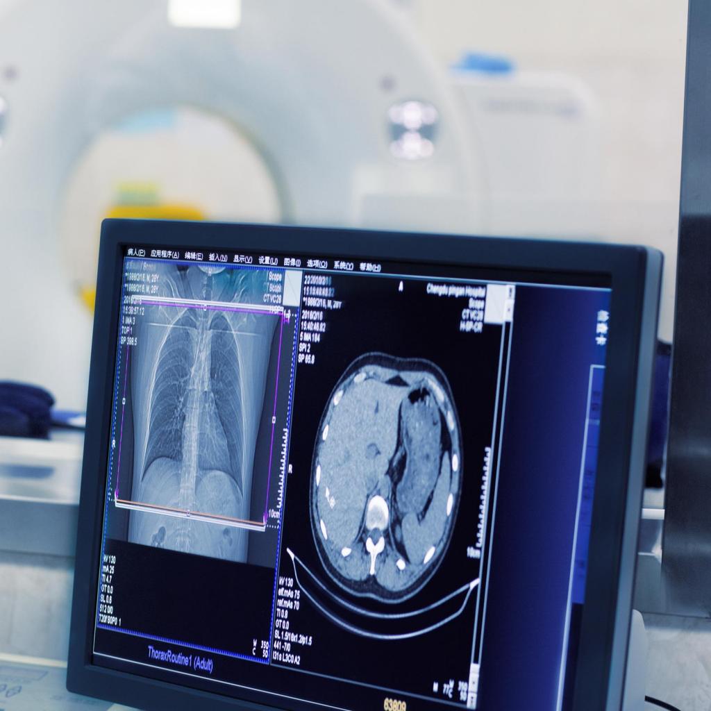 Soft Tissue Sarcoma | NYU Langone Health