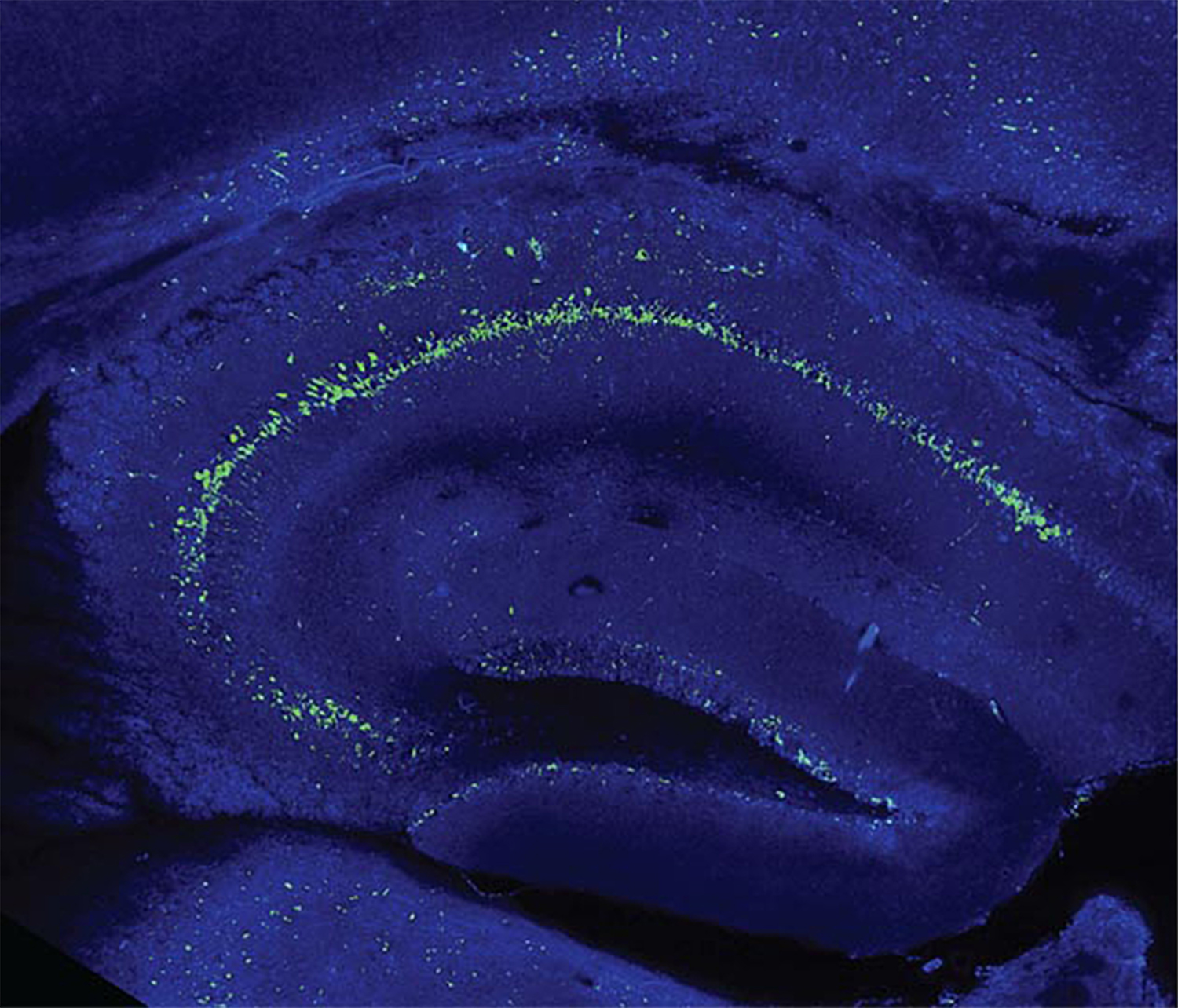 Broken Shuttle May Hinder Learning Across Several Brain Disorders | NYU ...