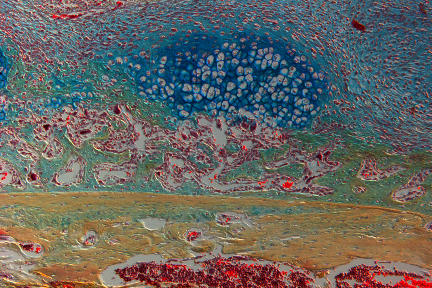 ‘Inflamm-aging’ Causes Loss of Bone Healing Ability in the Elderly ...