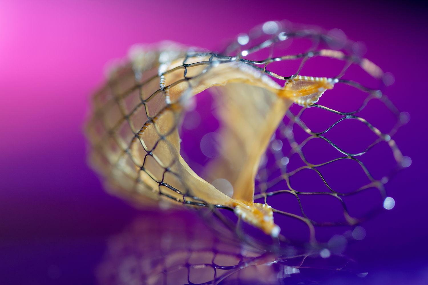 Bringing the Benefits of Transcatheter Aortic Valve Replacement (TAVR ...