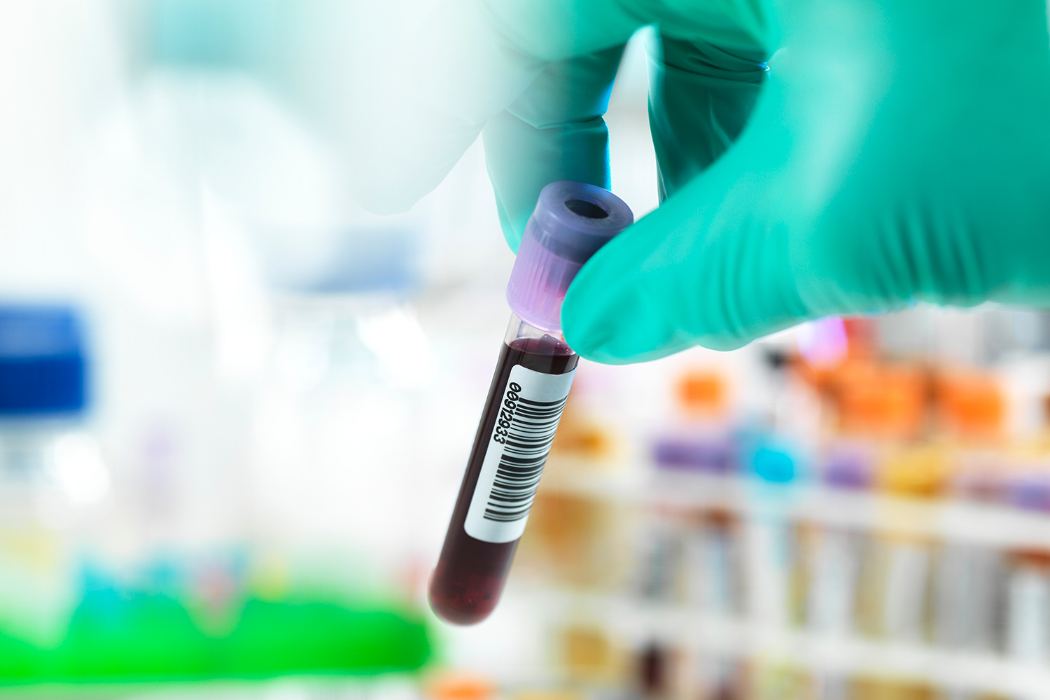 Clinical Trial to Test Blood Plasma from Recovered Patients as ...