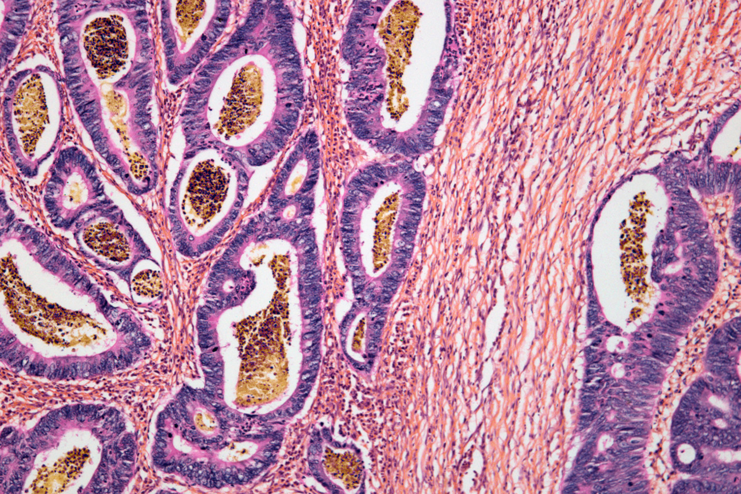 New York Daily News: Chadwick Boseman’s Death Highlights Racial ...