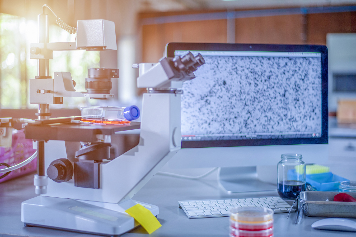 Experimental Compound Counters Diabetic Complications | NYU Langone News