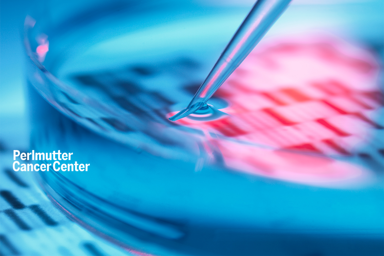 CBS New York: Perlmutter Cancer Center Medical Oncologist Discusses ...