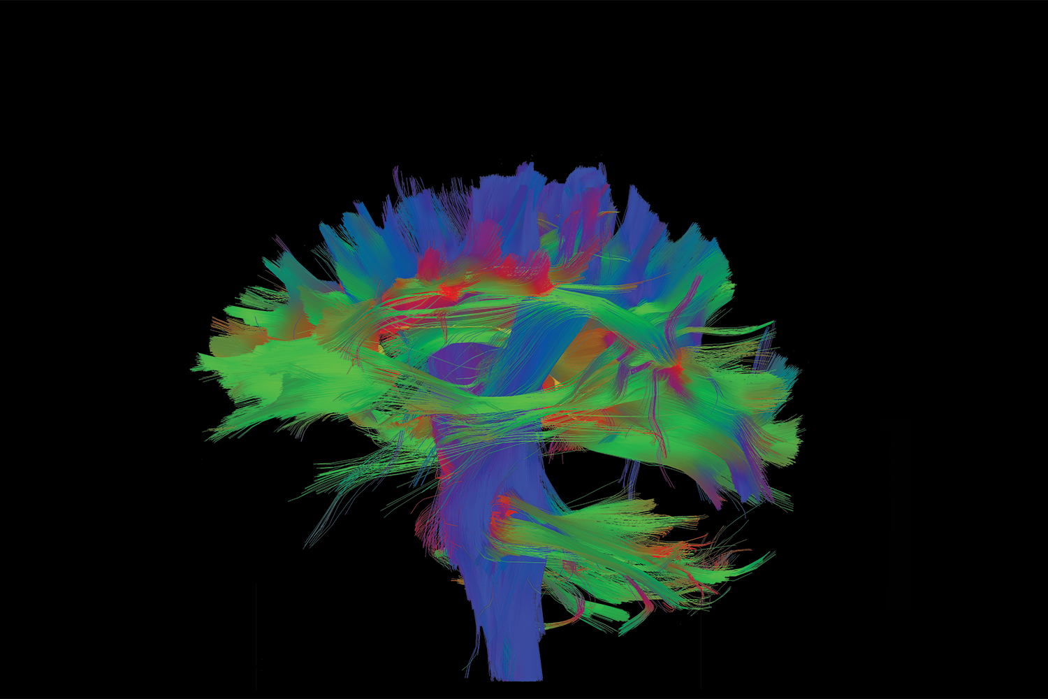 New Tool May Help Spot ‘Invisible’ Brain Damage in College Athletes ...