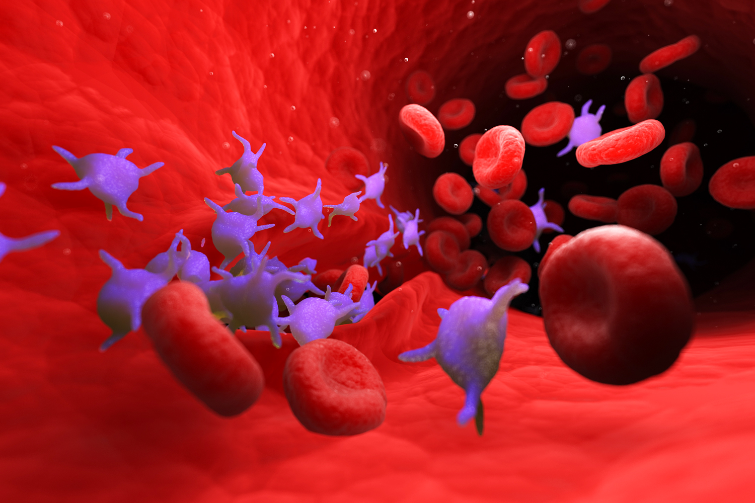 Blood Platelet Score Detects Previously Unmeasured Risk of Heart Attack ...