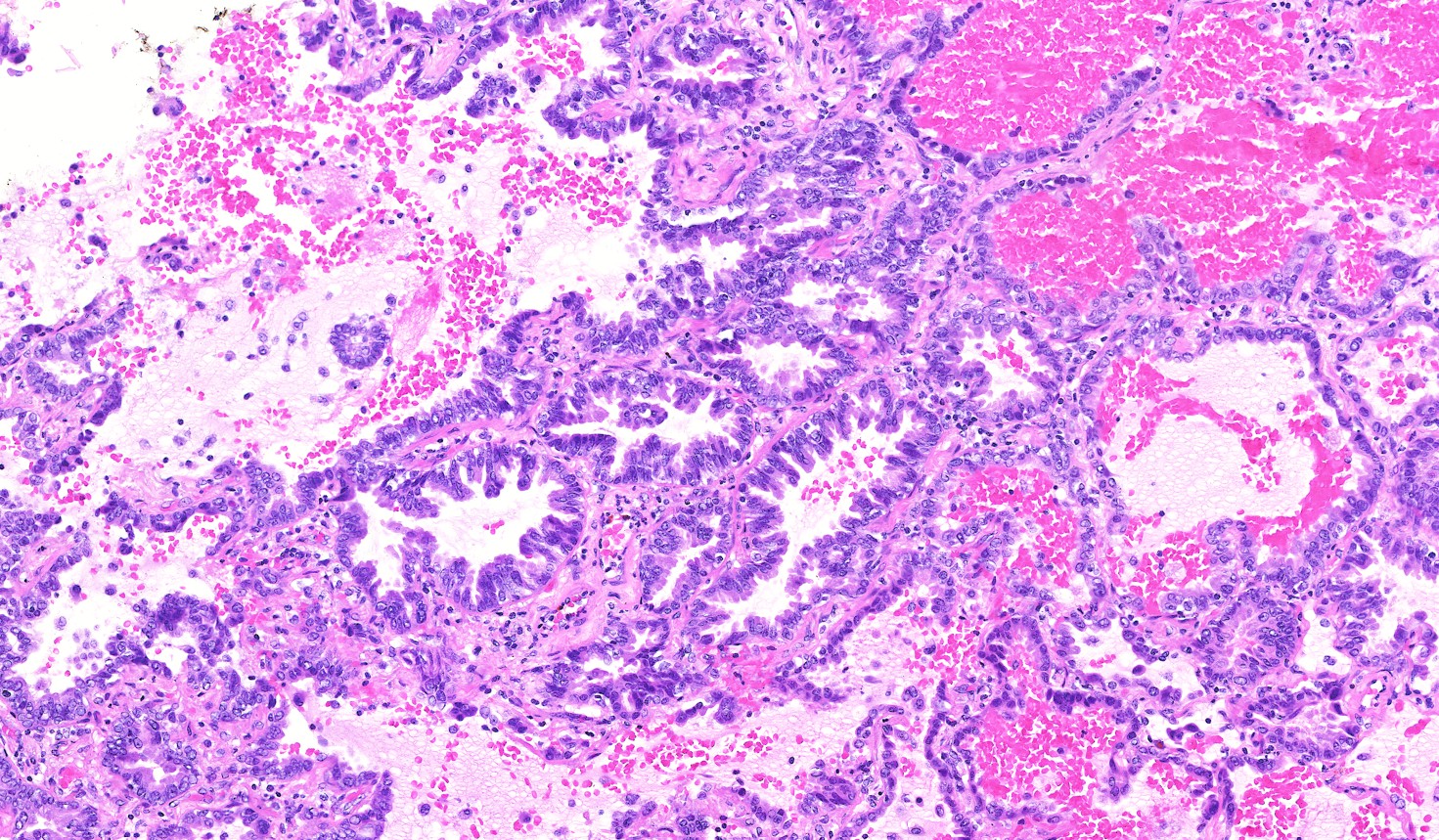 As Microscopes Give Way to Scanners, Digital Pathology Makes Its Debut ...