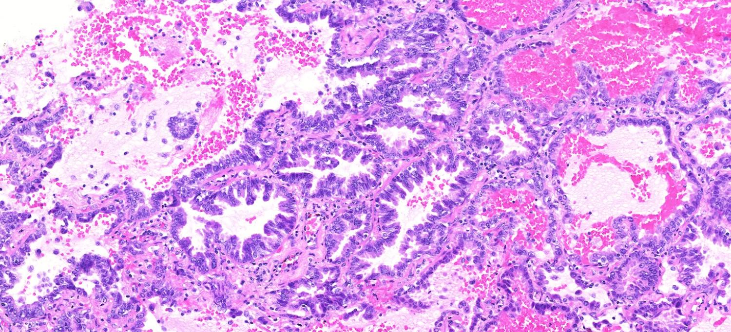 As Microscopes Give Way to Scanners, Digital Pathology Makes Its Debut ...